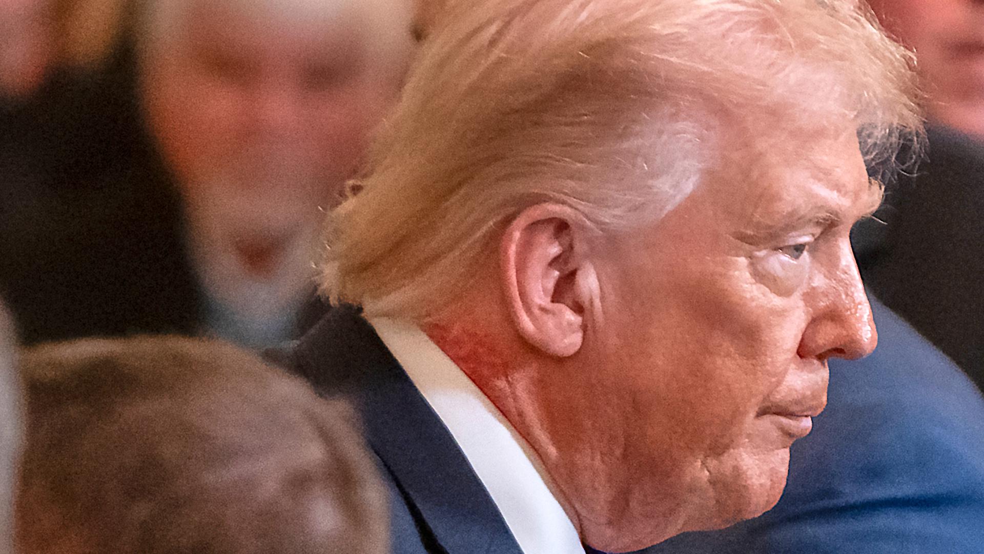 Trump's red neck caused by 'common skin cream,' White House says | wkyc.com