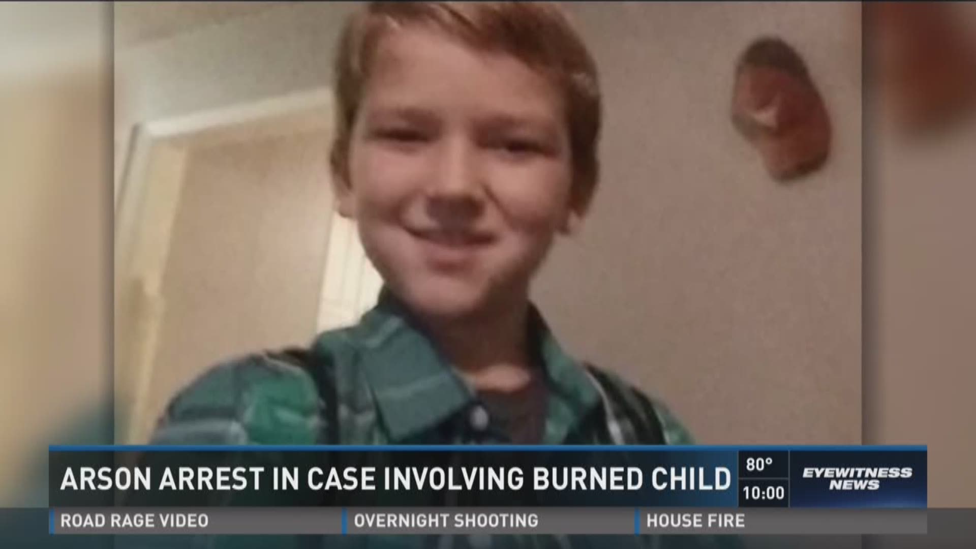 Disabled child in coma after being set on fire, one arrest made | wkyc.com