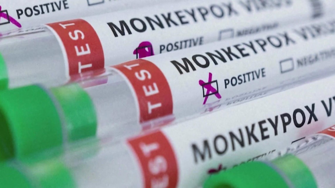 Cleveland reports 85 total monkeypox cases, highest in Ohio | wkyc.com