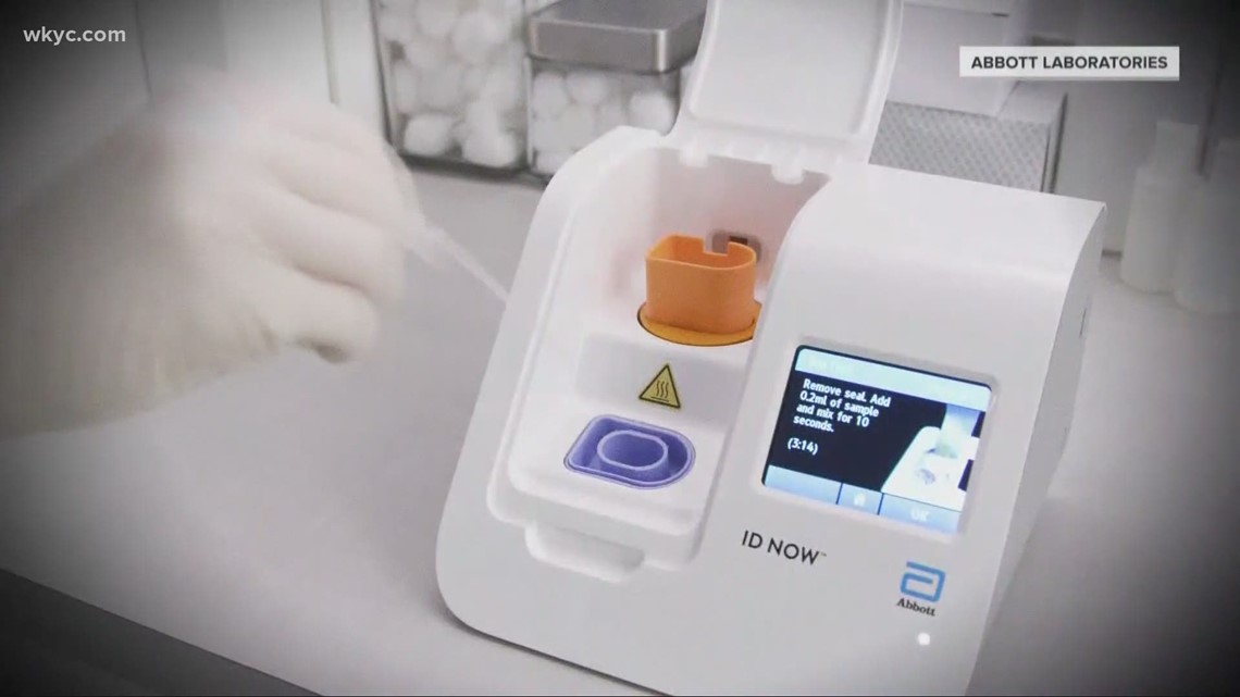 Comparing rapid COVID-19 tests versus PCR | wkyc.com