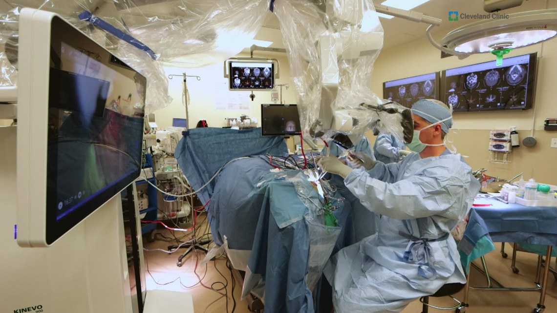 Minimally invasive brain surgery for aneurysm at Cleveland Clinic ...