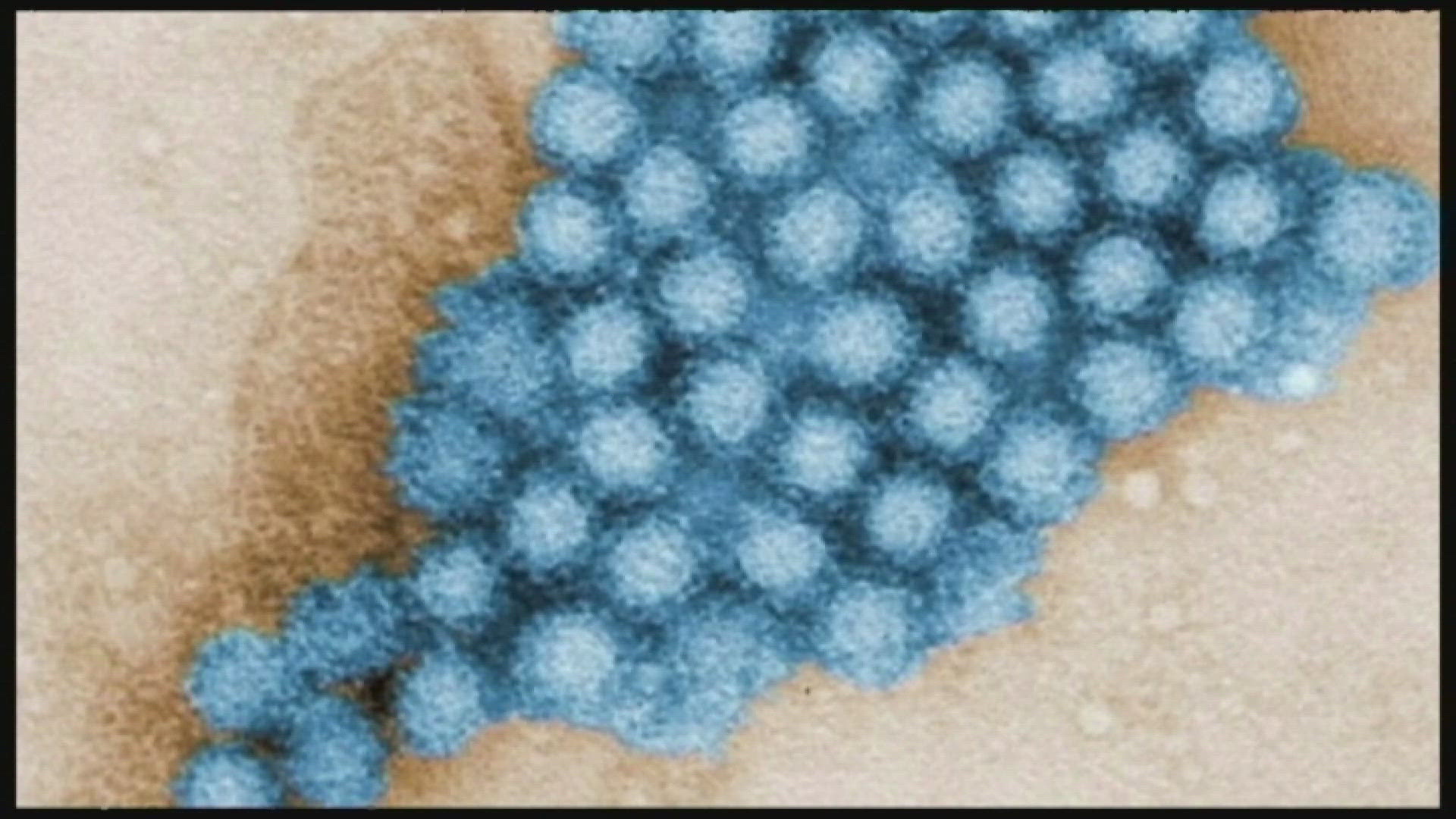 Respiratory virus season is raging in Northeast Ohio | wkyc.com