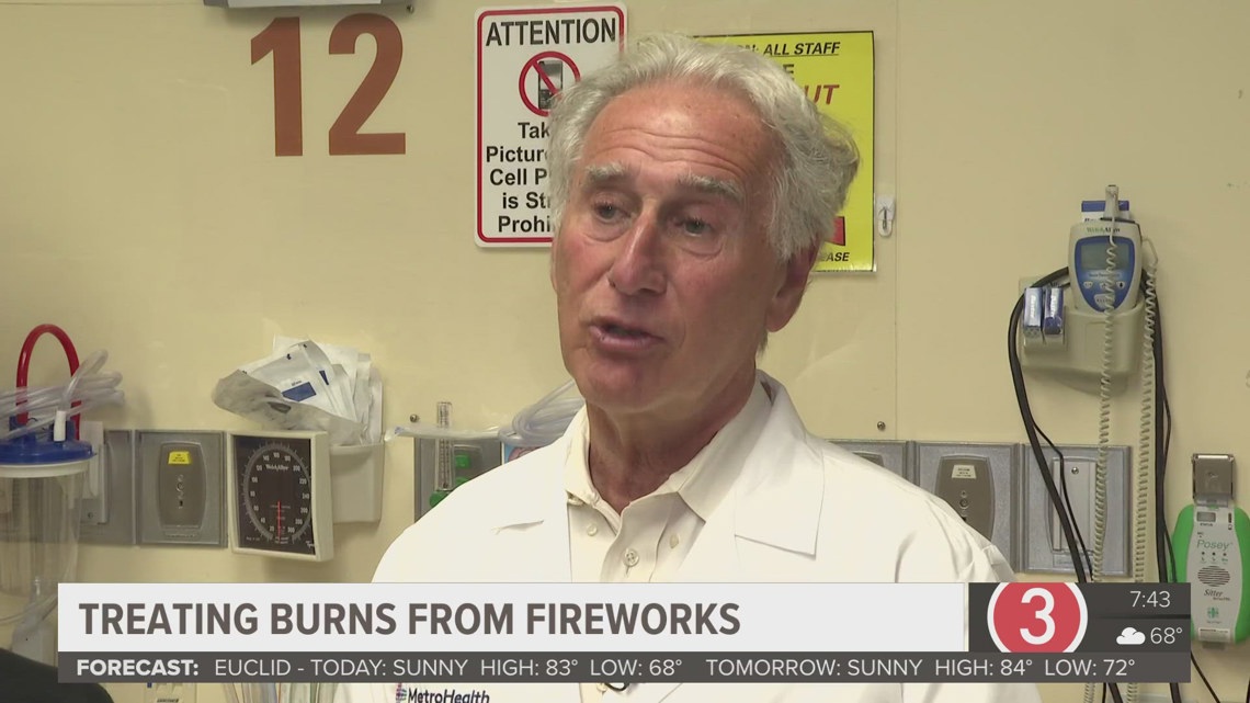 Treating burns from July 4 fireworks: What doctors recommend | wkyc.com
