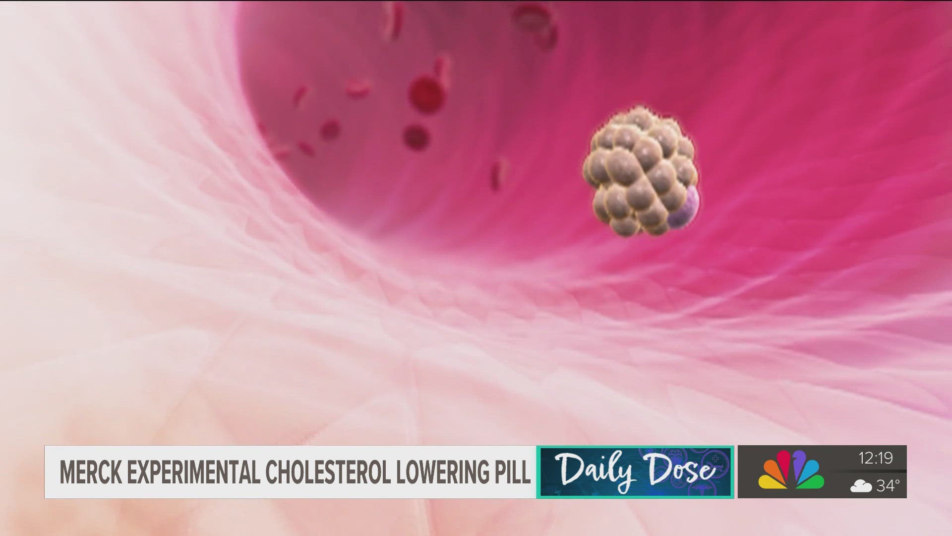 Monday's Daily Dose with Monica Robins: Gene therapy breakthrough, new ...