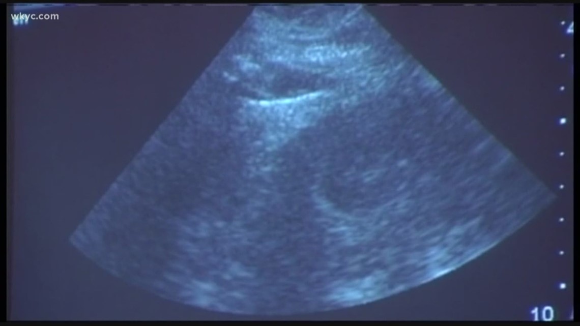 A look at abortion rights 47 years after Roe v. Wade | wkyc.com