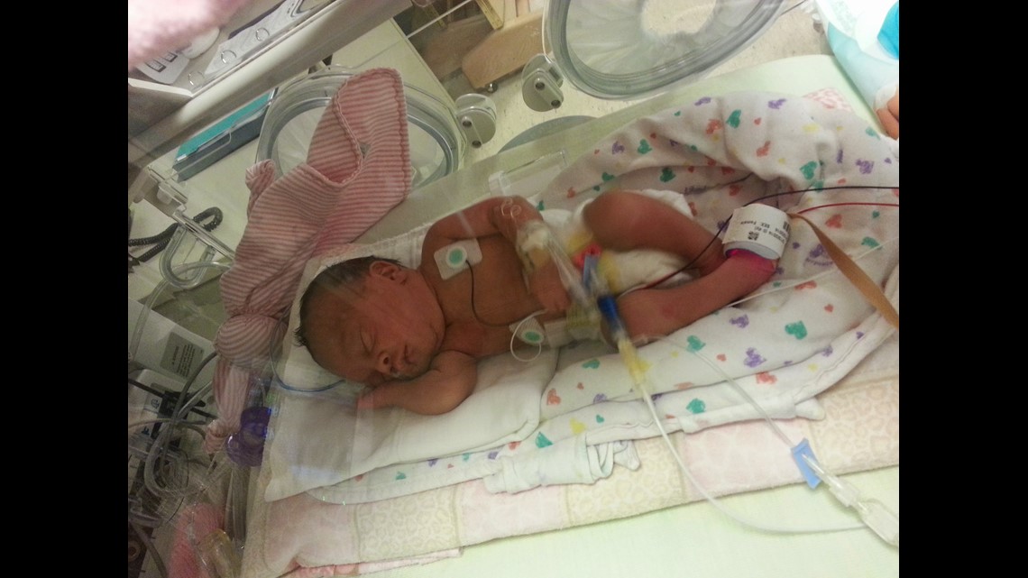 MiraCLE: 5-year-old girl survives grim prognosis while battling a birth ...