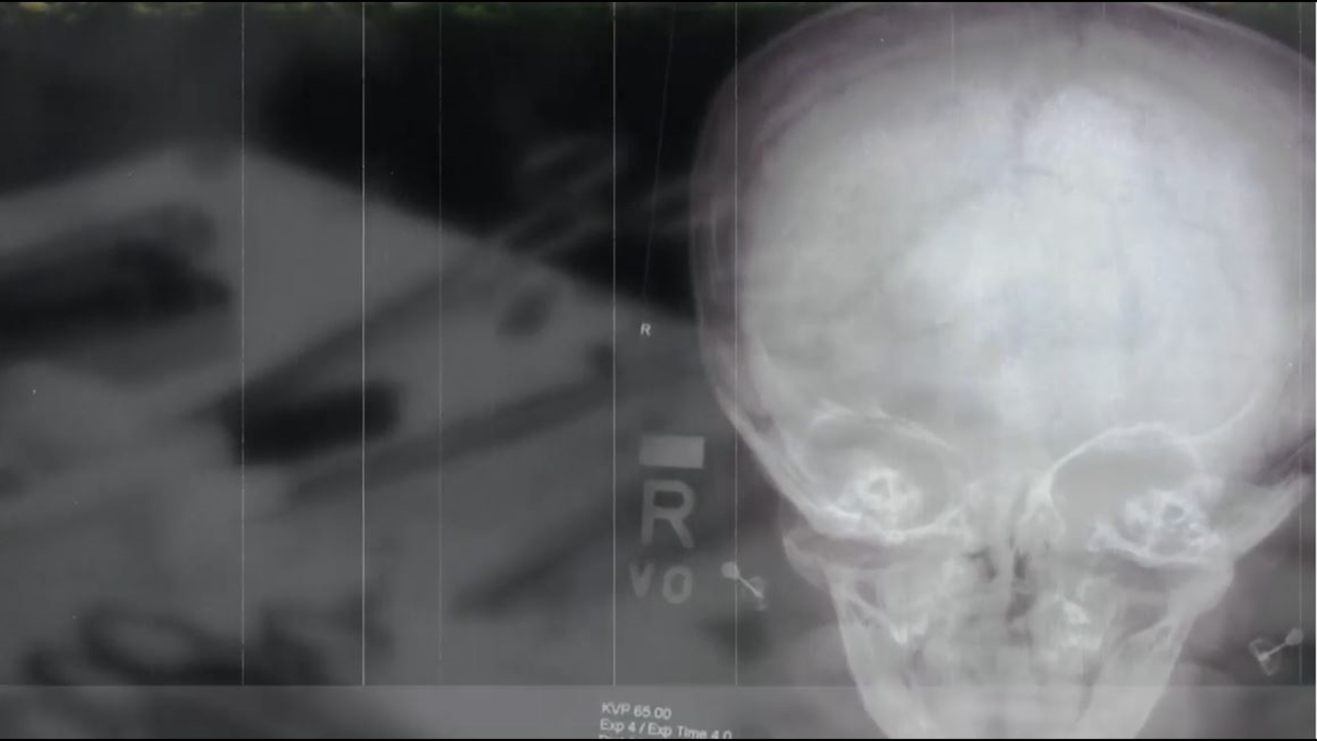 3News investigates the 'melon heads' of Kirtland | wkyc.com