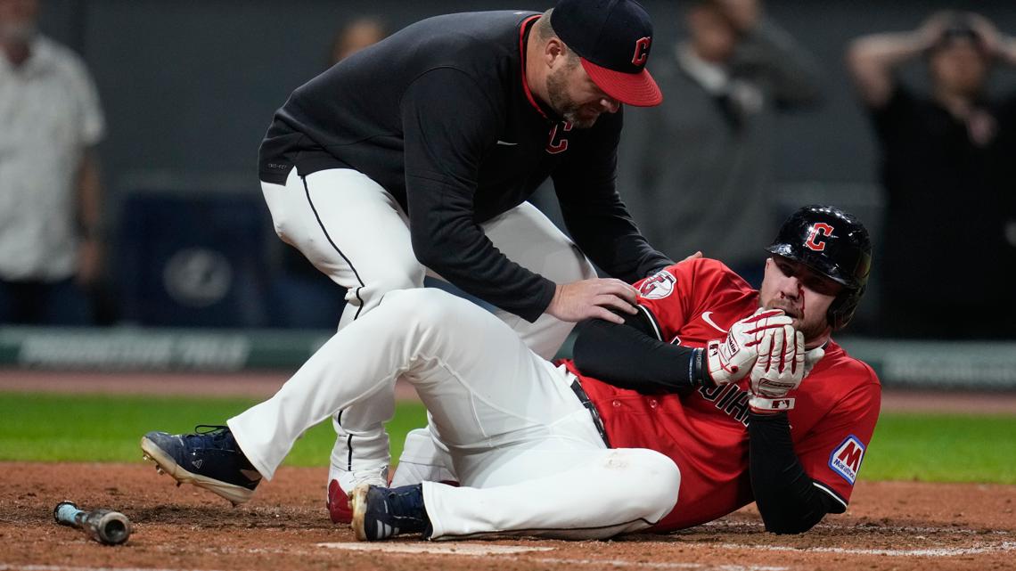 Guardians' David Fry hospitalized after being hit in face by deflected pitch | wkyc.com