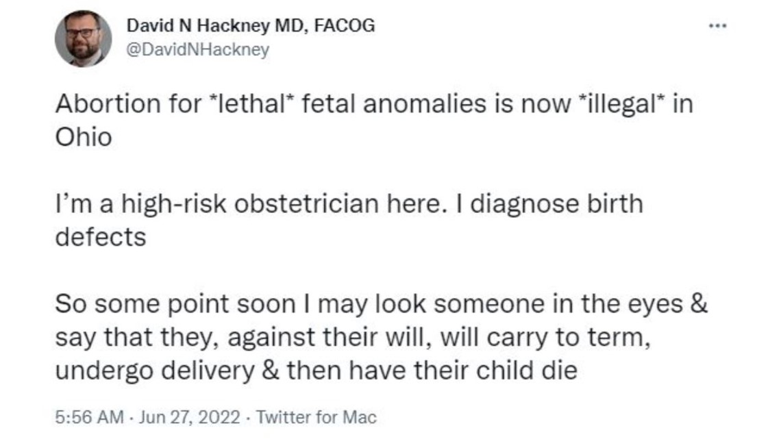 Cleveland doctor sounds alert following overturn of Roe v. Wade | wkyc.com