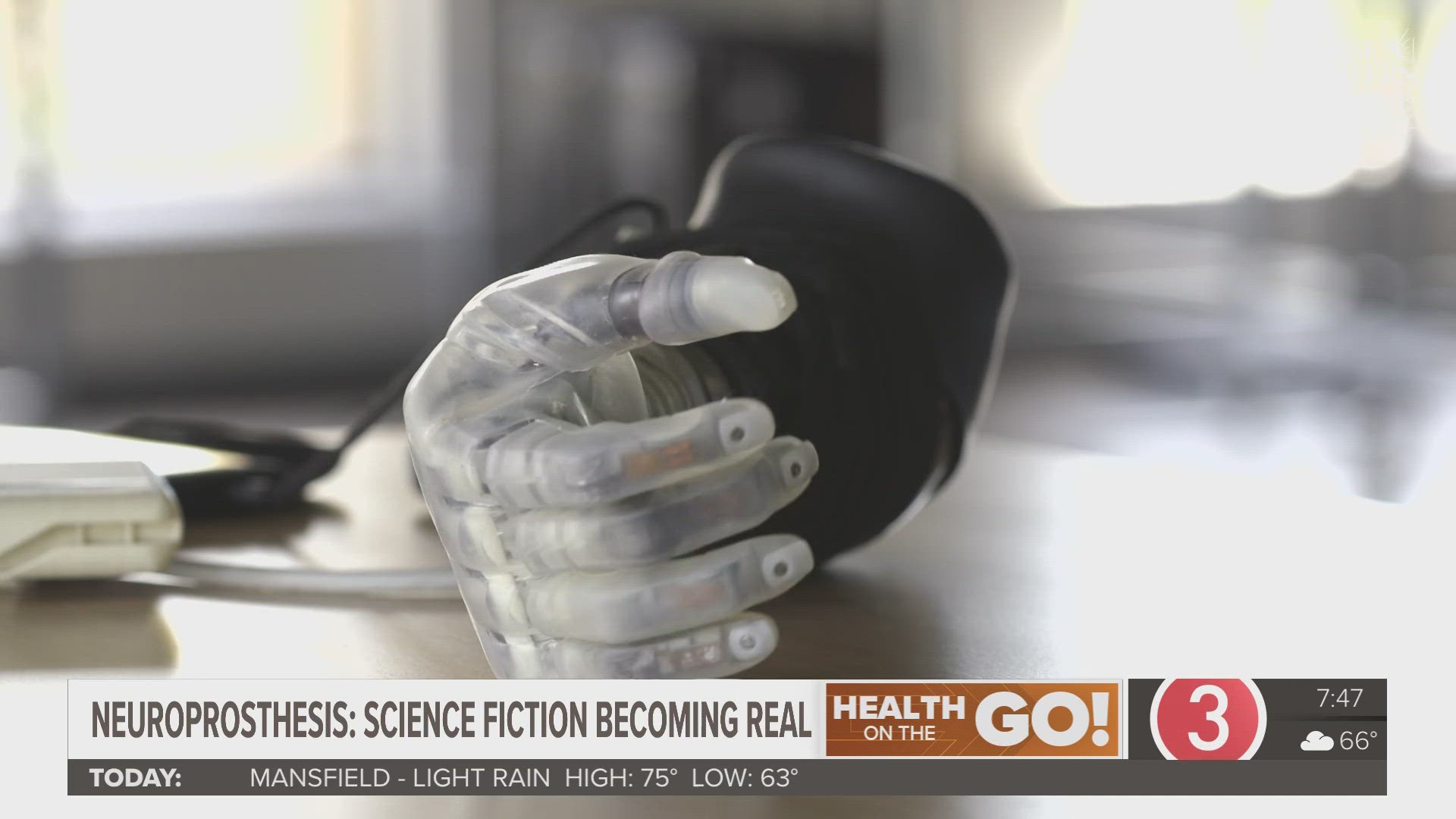 CWRU researchers testing touch-restoring prosthetic hand advancements ...