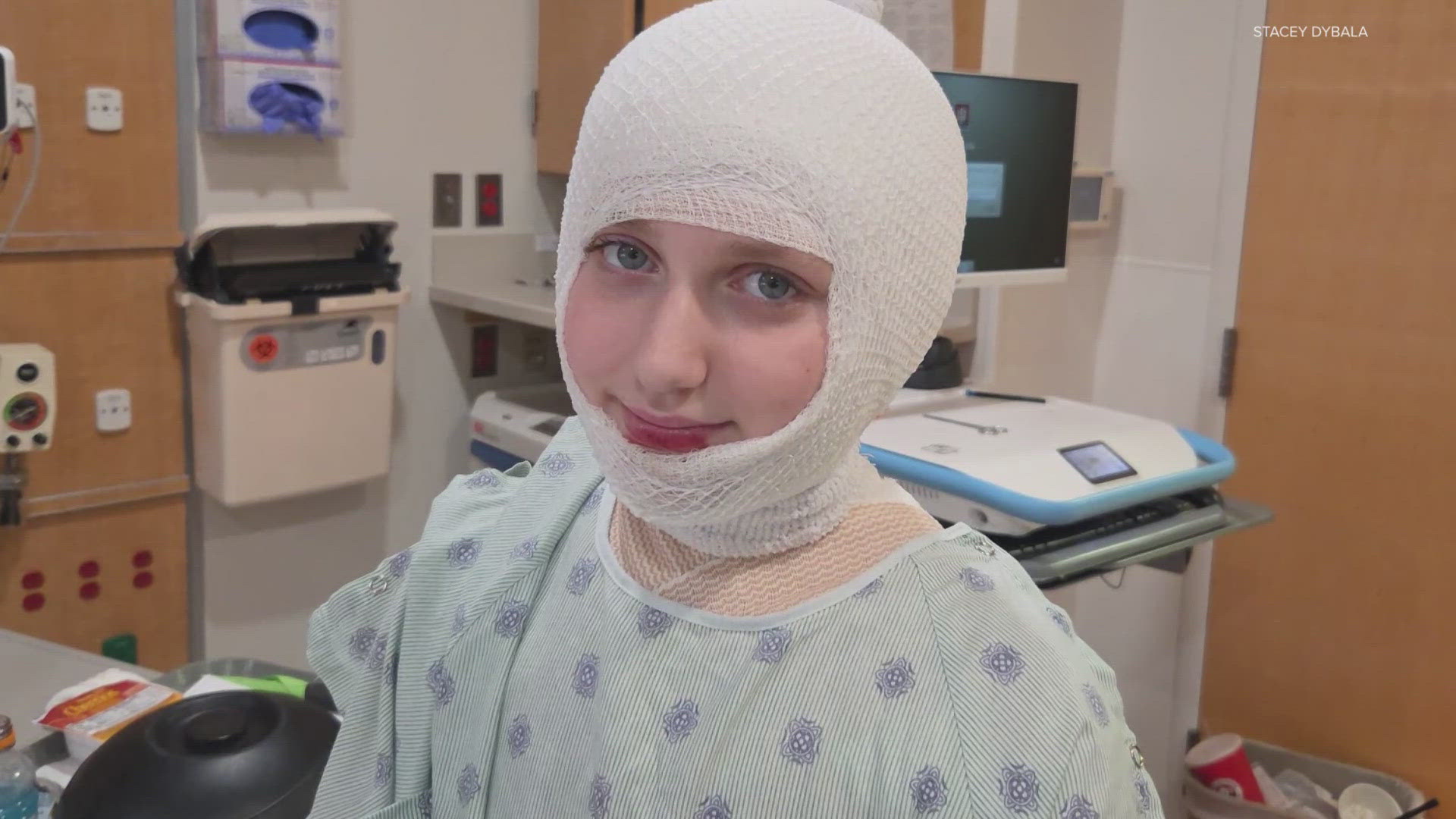 A 12-year-old got severe burns from a TikTok trend. Now she's warning ...