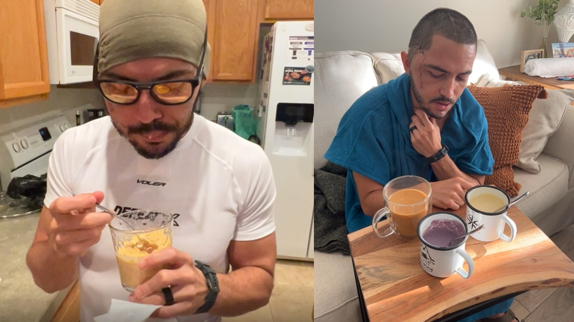 Florida man recounts alligator attack and his recovery journey | wkyc.com