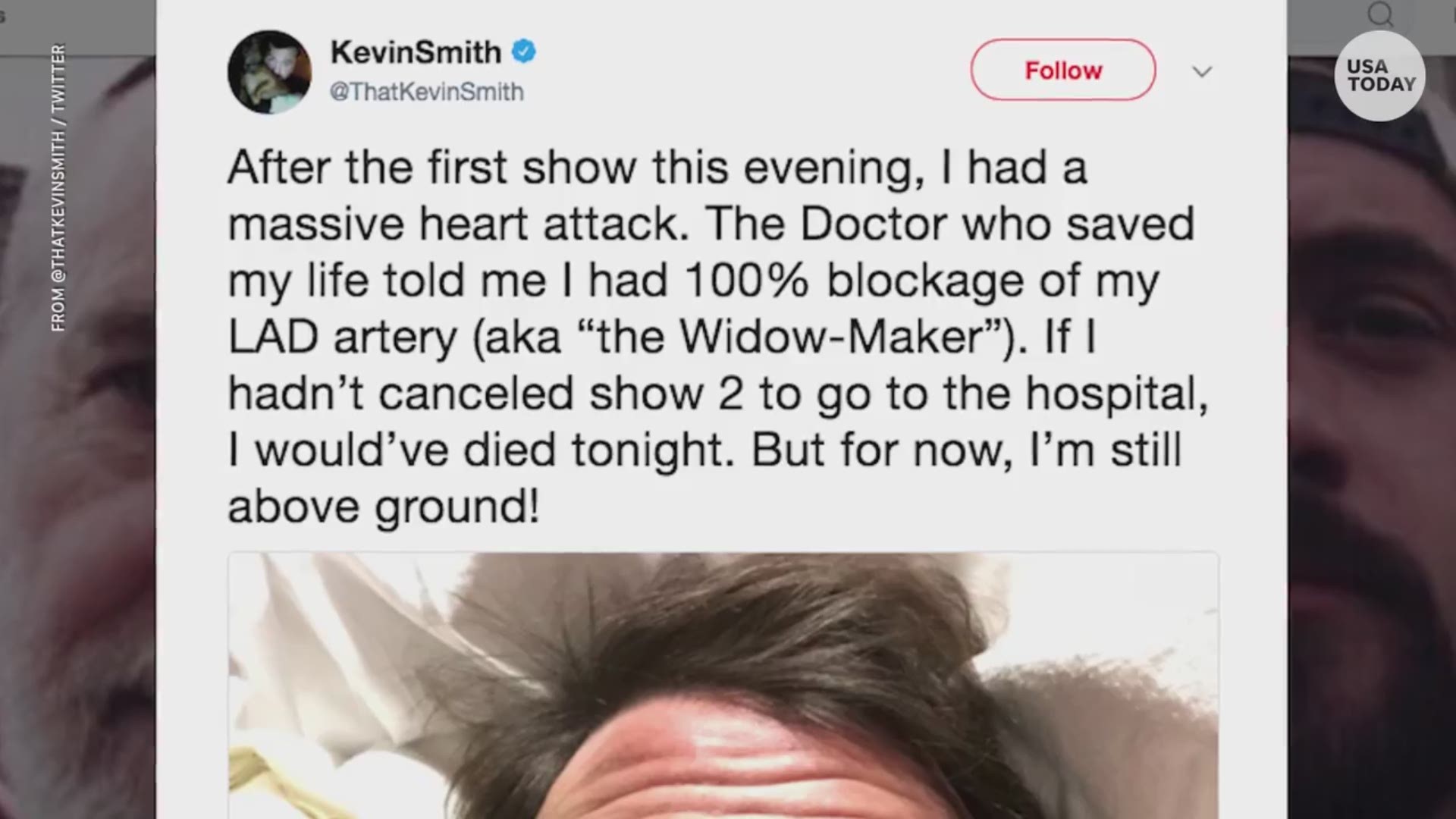 Kevin Smith: 'I was never really in pain' during 'Widowmaker' heart ...