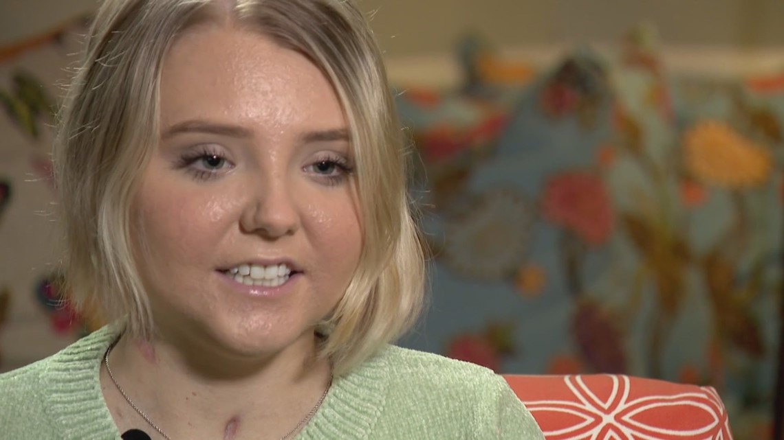 Hannah Goetz, who received double transplant as a teen dies at 21 ...