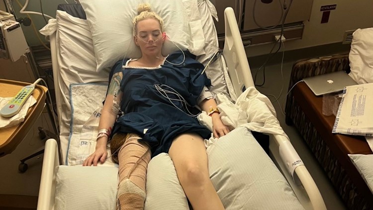 Atlanta Womans Leg Amputated From Rare Flesh Eating Bacteria